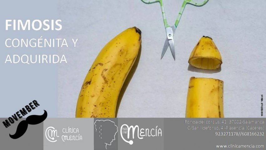 FIMOSIS CONGÉNITA Y ADQUIRIDA